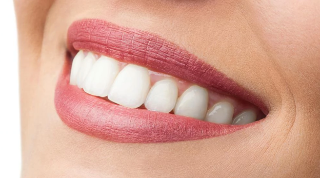 Teeth Whitening - Amate Cosmetic Surgery & Spa
